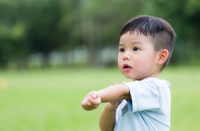 Common Skin Issues Children Face - Mummyfique